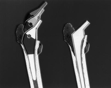 Research | Joseph F. Fetto, M.D. | Orthopaedic Surgery